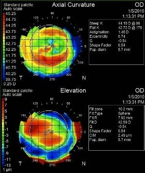 Advanced Technology - Family Eye Care